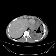 JOURNAL OF THE ROYAL MEDICAL SERVICES